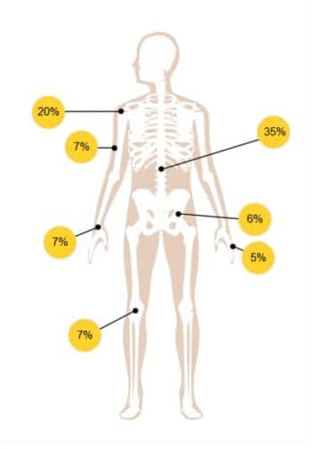 Manufacturing: injury hotspots - Manufacturers' Monthly